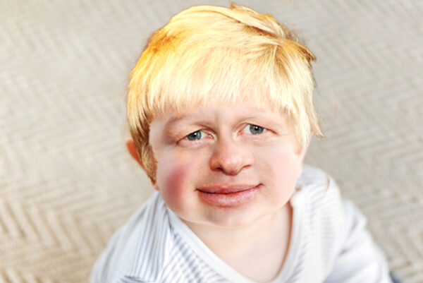 What Might the New Boris Baby Look Like? - Daily Squib